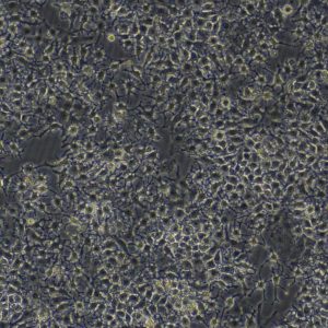 HuH-7,HuH7,Huh7,HUH7人肝癌细胞(STR鉴定正确)